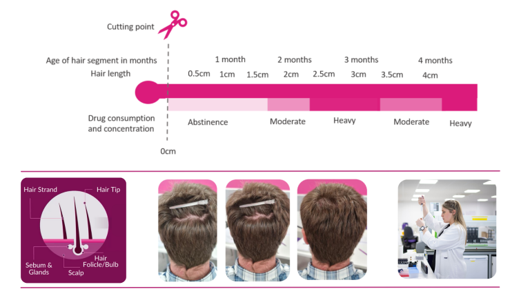 The role of hair strand testing in family court – a Cansford Labs case ...